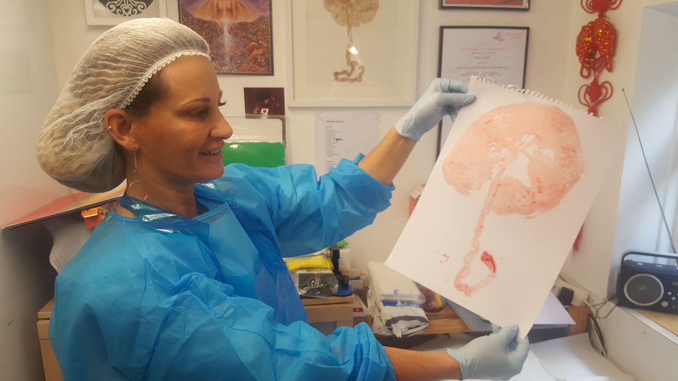 IPEN's World Renowned Placenta Remedies Training Program - IPEN